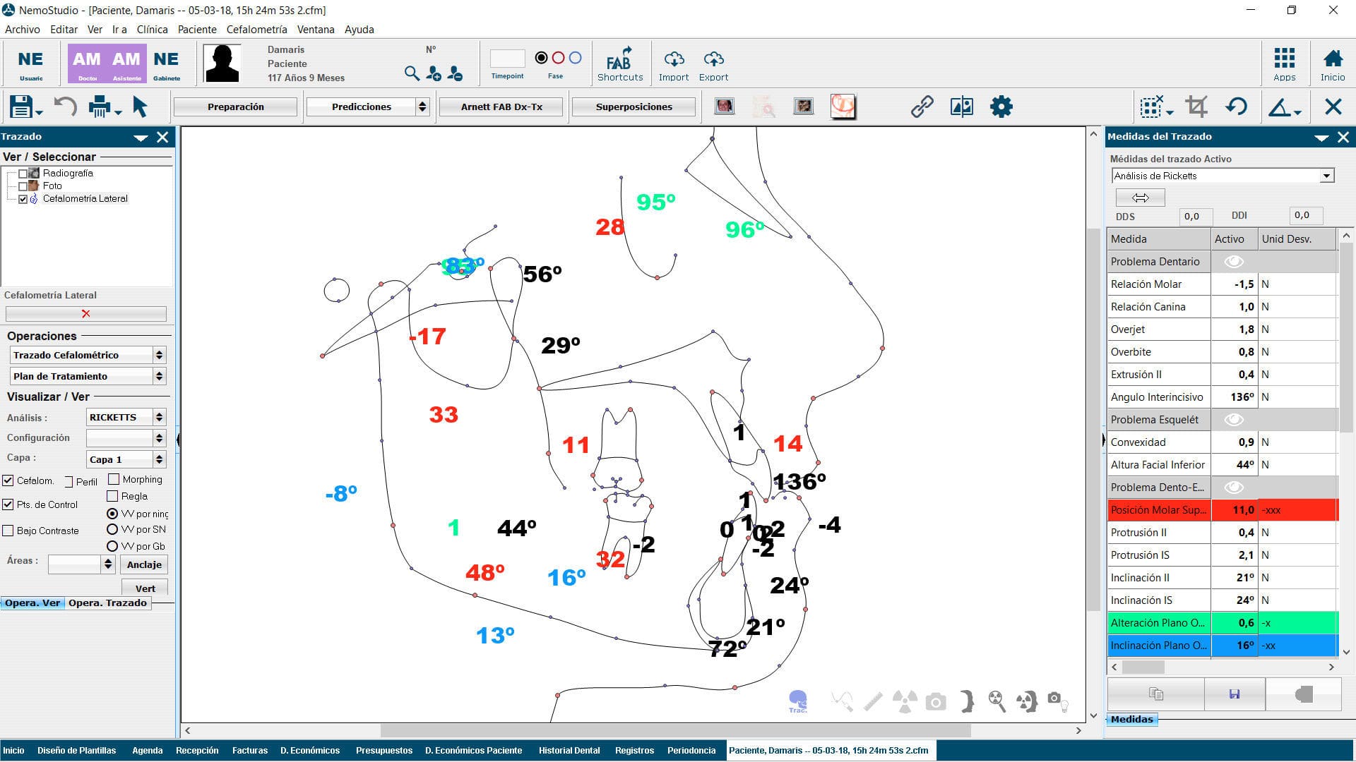 Clinical software - NemoCeph - Nemotec - radiology / for orthodontics ...