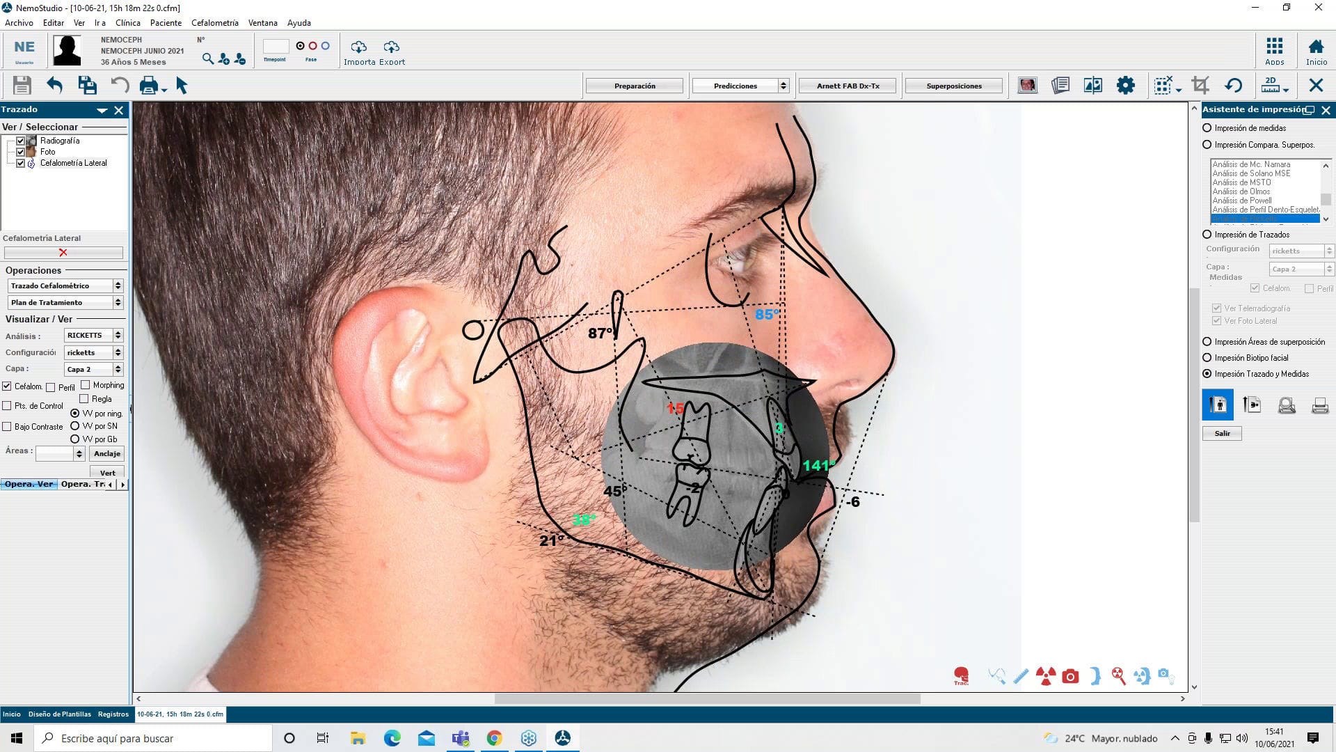 Diagnostic software - NemoCeph - Nemotec - image analysis / capture / cephalometric analysis