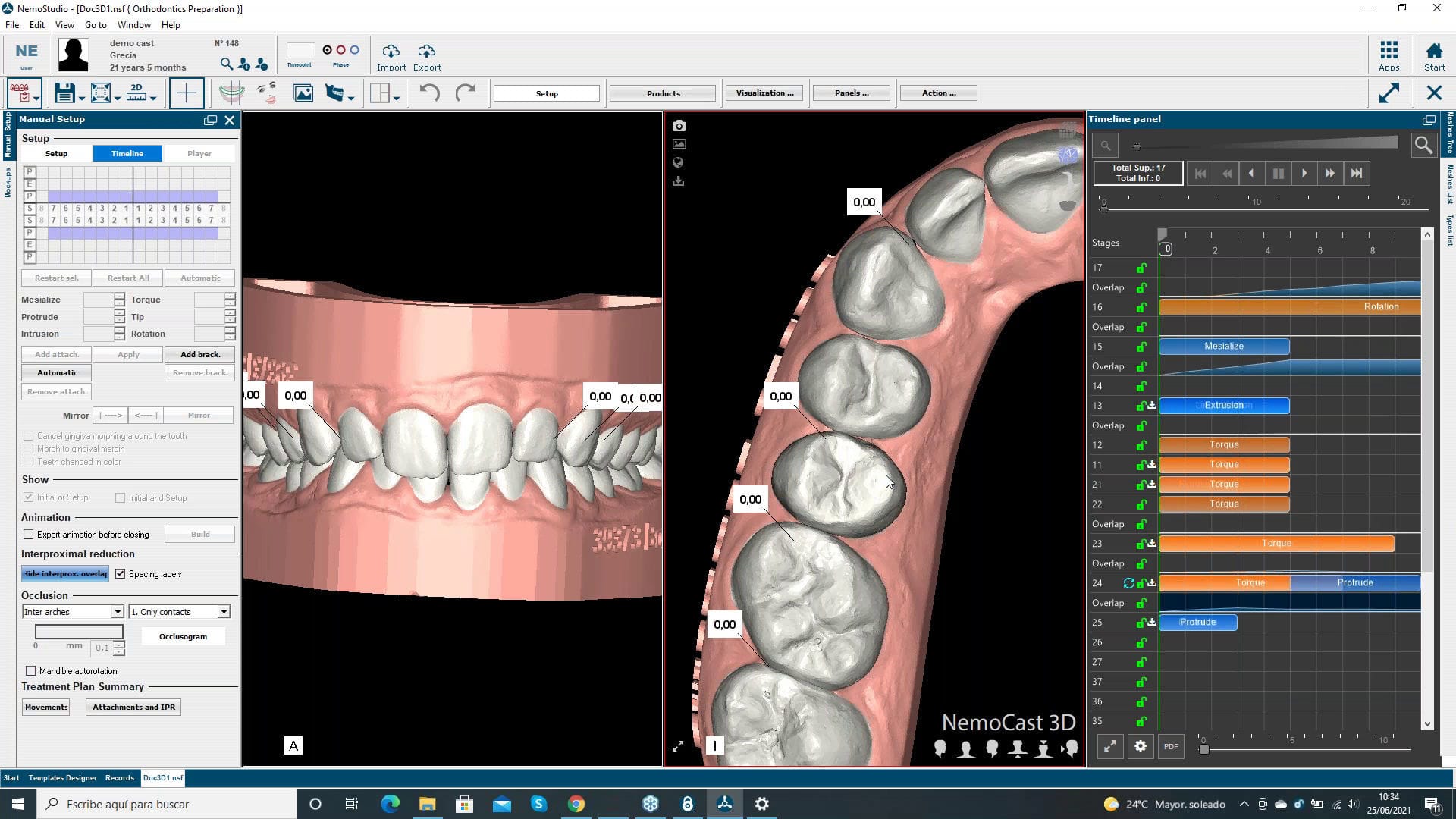 Dental imaging software - NemoCast - Nemotec - DICOM viewing / analysis ...