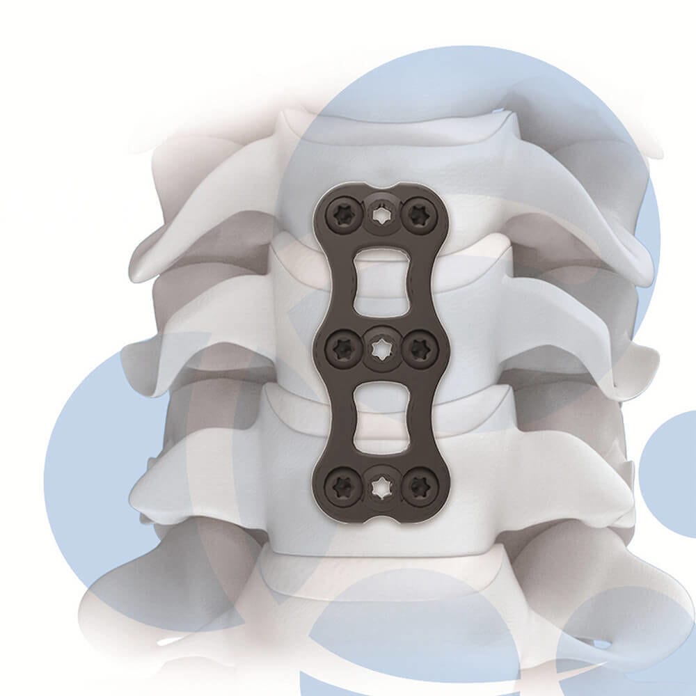 Cervical arthrodesis plate - ACE - Canwell Medical - 1 level
