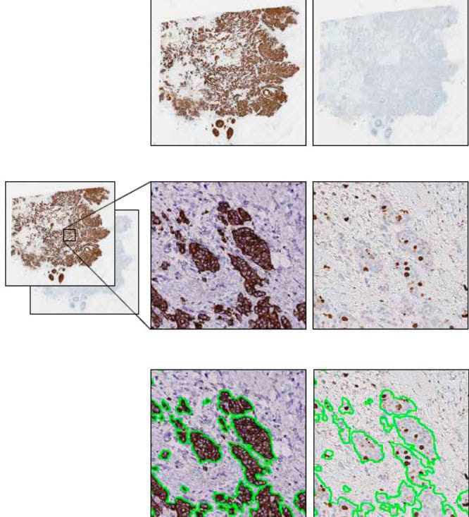 Image analysis software module - VirtualDoubleStaining™ - Visiopharm ...