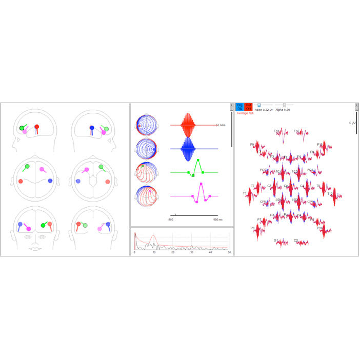 Analysis software - BESA GmbH - simulation / EEG