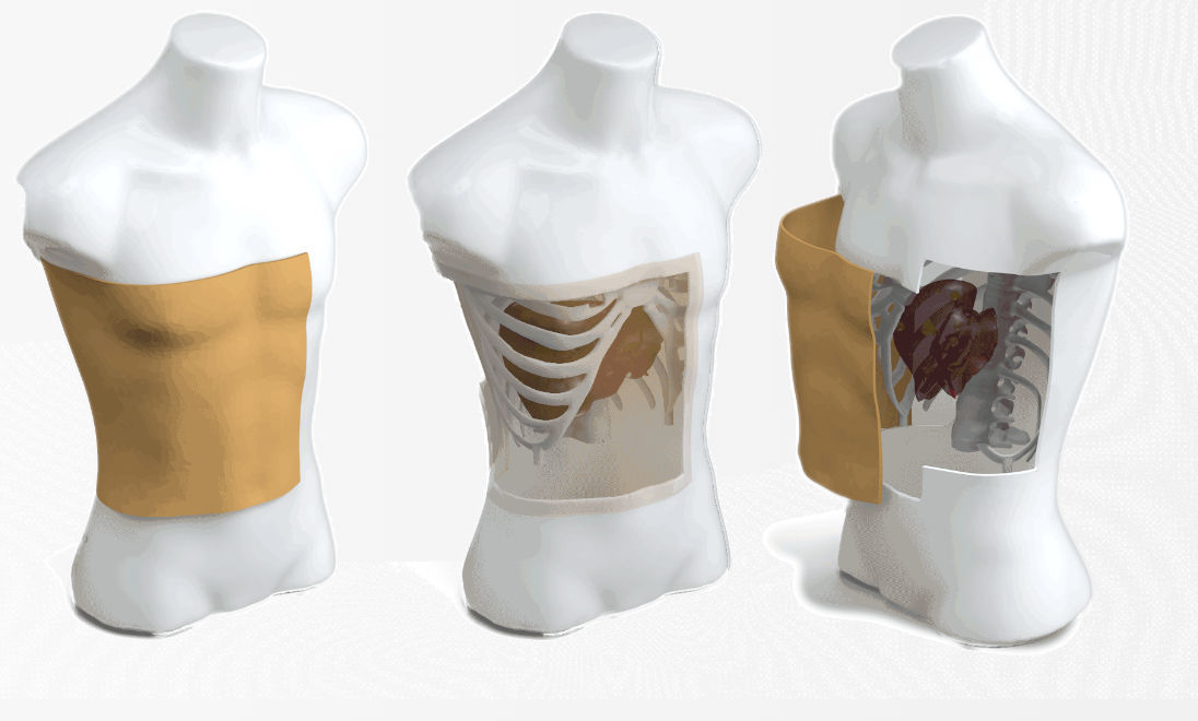 Radiosurgery test phantom - Quant® - CAScination - torso