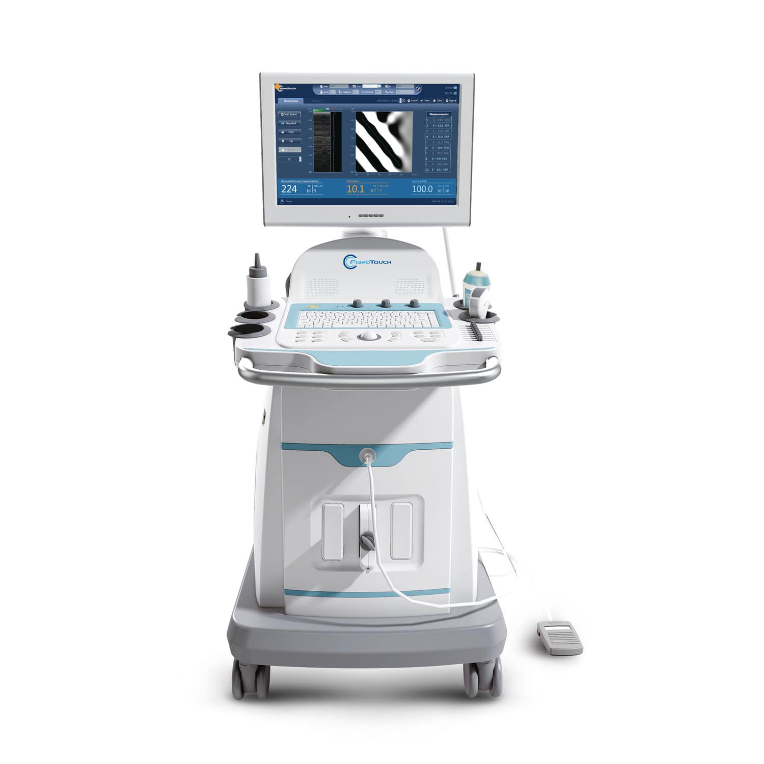 Liver cirrhosis ultrasound elastography system - FT1000 - Hisky Medical ...