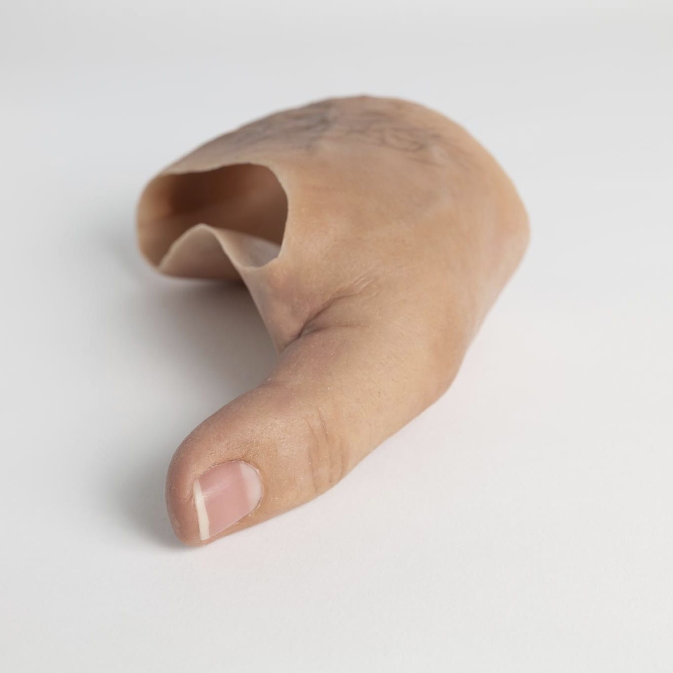 Hand cosmetic prosthesis - schubert and braun prothesenwerk - partial ...