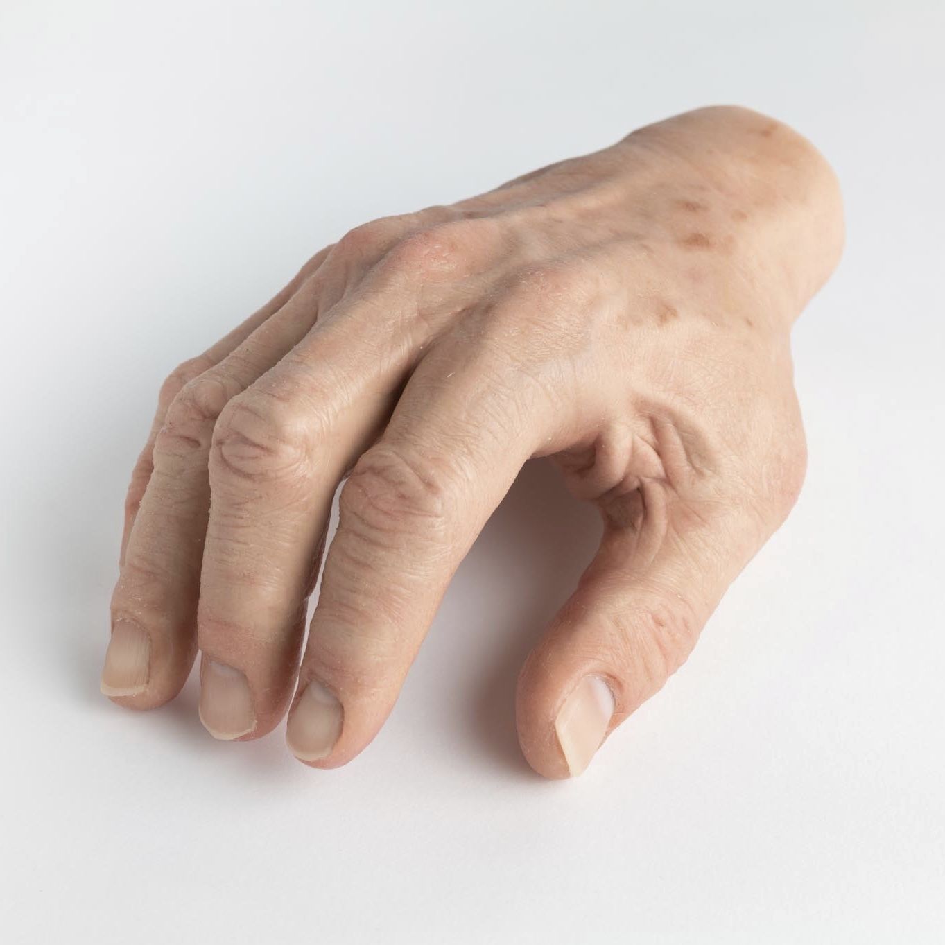 Hand cosmetic prosthesis - schubert and braun prothesenwerk - adult