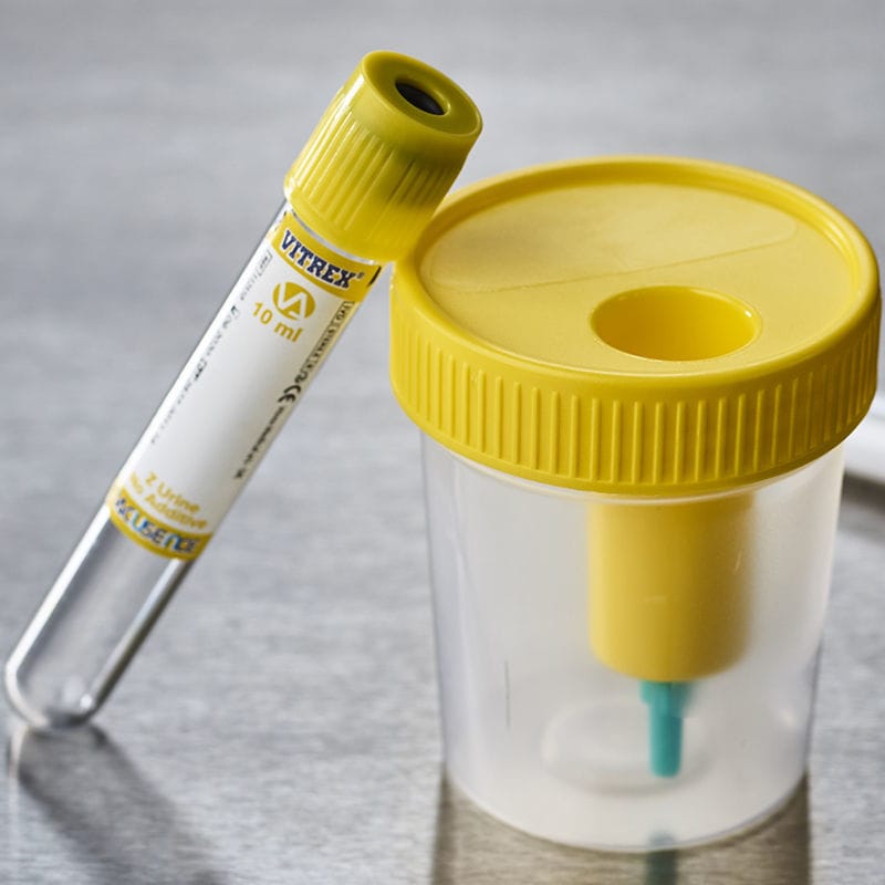 Laboratory collection tube - 115509+ - Vitrex Medical A/S - cylindrical ...