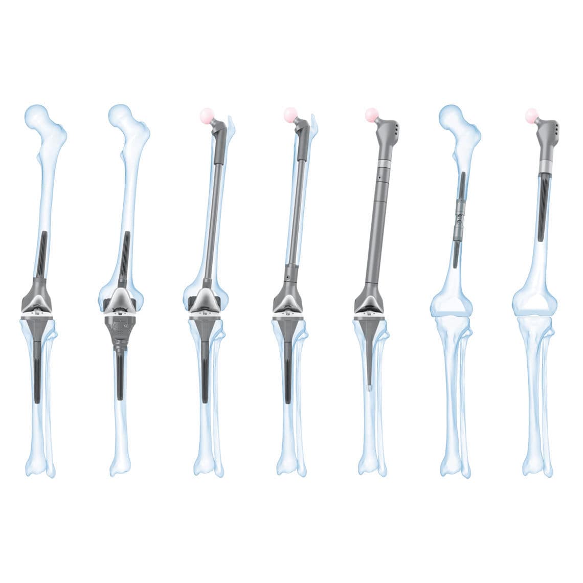 Total knee prosthesis - MEGASYSTEM-C - Waldemar Link - revision ...