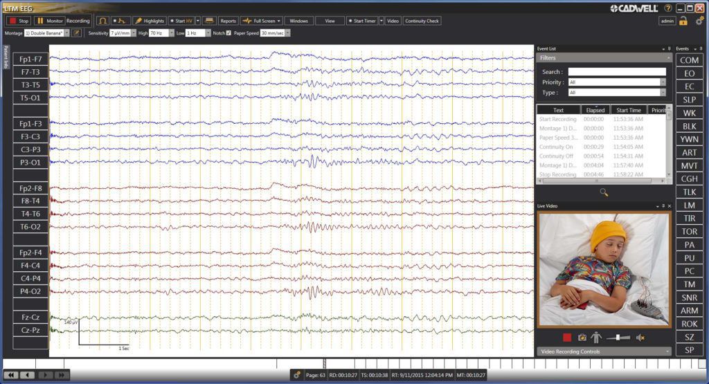 EEG software - ARC SYNOPSIS - Cadwell Industries - control / monitoring ...