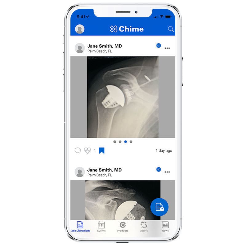 Orthopedic surgery iOS application - Chimie - Exactech - for ...
