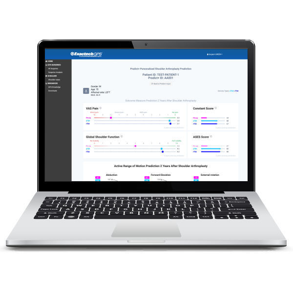 Data analysis software - Predict+® - Exactech - data management / machine learning / clinical