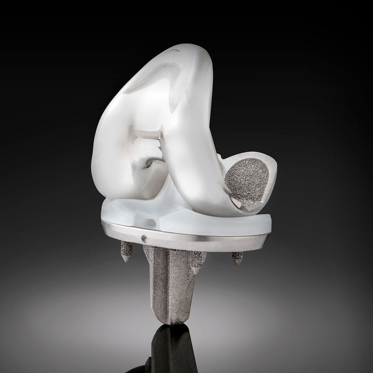 Total knee prosthesis - Truliant® Porous - Exactech - mobile-bearing ...