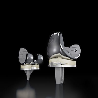 Total knee prosthesis - TriVerse™ - Exactech - fixed-bearing / cemented