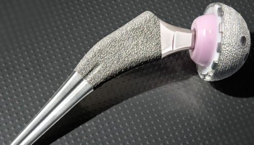 Cementless femoral stem - Alteon® Tapered - Exactech