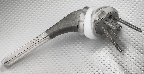 Reverse shoulder prosthesis - Equinoxe Reverse - Exactech - Videos