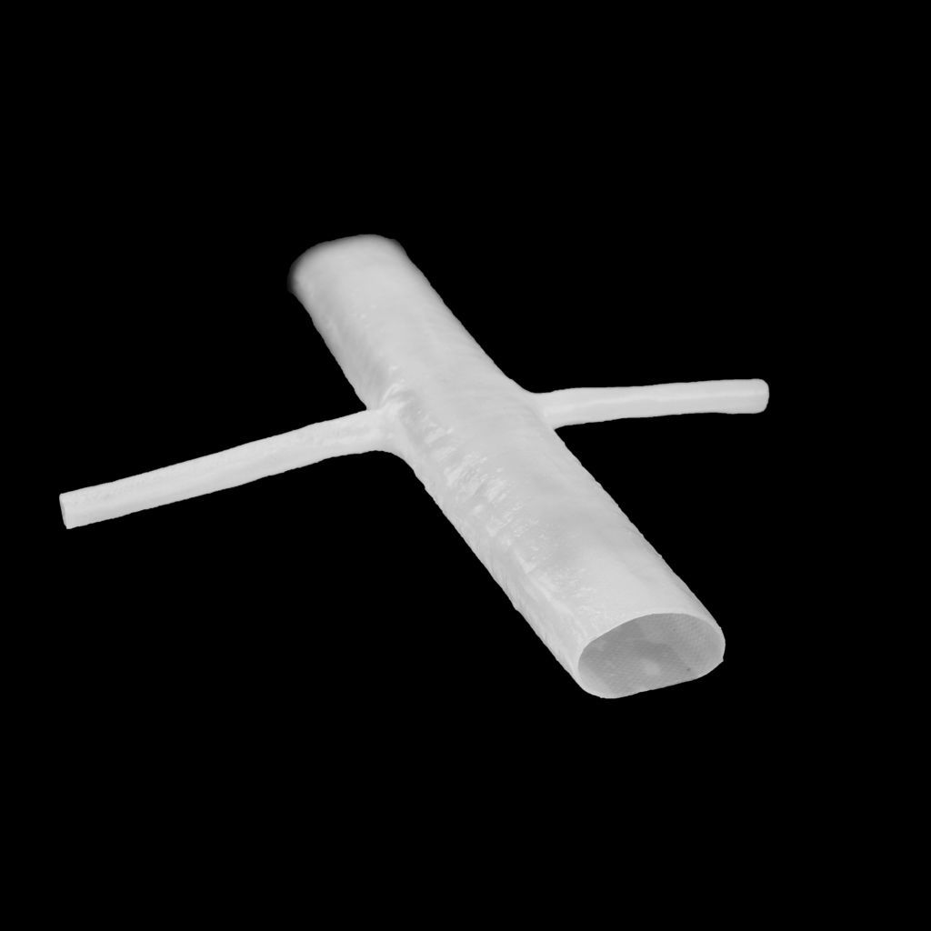 Medical Term For Surgical Puncture Of The Abdomen at George Farrow blog