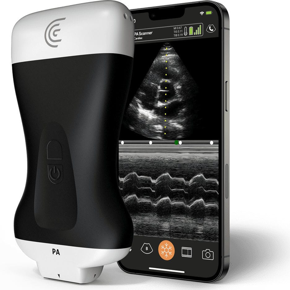 Hand-held ultrasound system - PA HD3 - Clarius Mobile Health - for ...