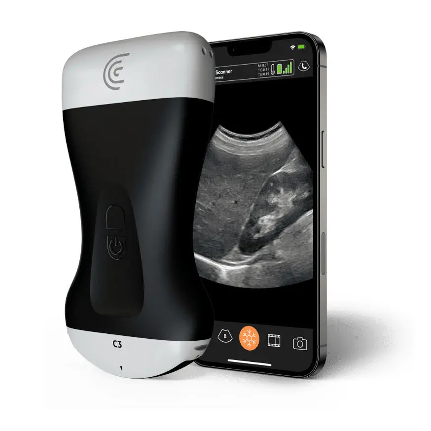 Hand-held Ultrasound System EC7 HD3 Clarius Mobile Health, 40% OFF