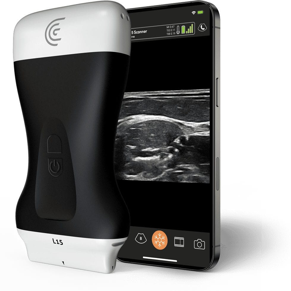 Hand-held ultrasound system - L15 HD3 - Clarius Mobile Health - for intraoperative ultrasound ...