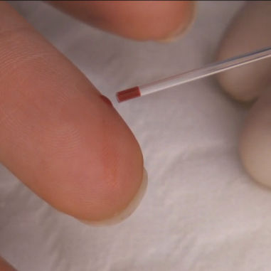 Capillary puncture simulation module - SIMTICS - nursing care / web-based