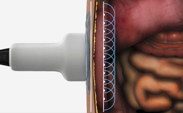Ultrasound imaging simulation module - Physics 1 - SIMTICS - anatomy ...