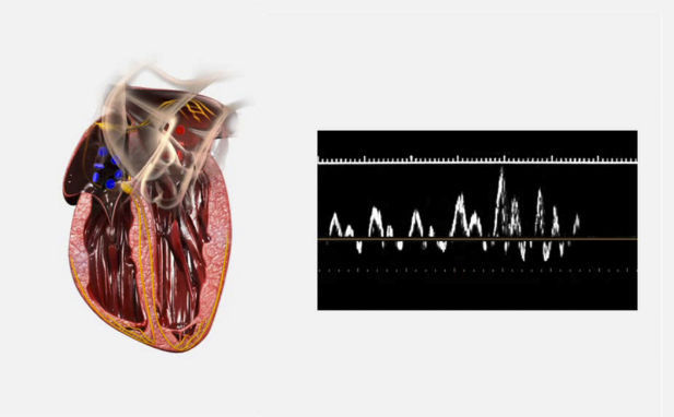 Education software module - Physics 2 - SIMTICS - for ultrasound ...