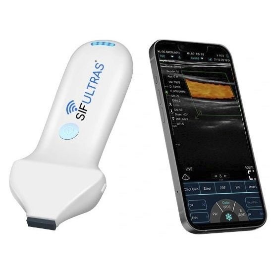 Hand-held ultrasound system - SIFULTRAS-3.35 - SIFSOF - for skin ...