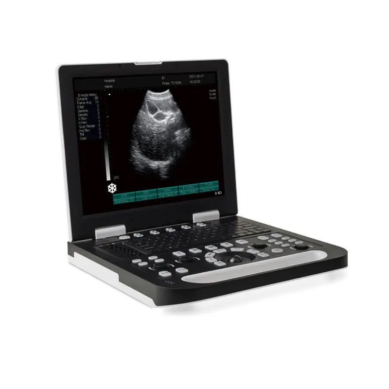 Portable ultrasound system - DP-50 Plus - Promed Technology - for ...