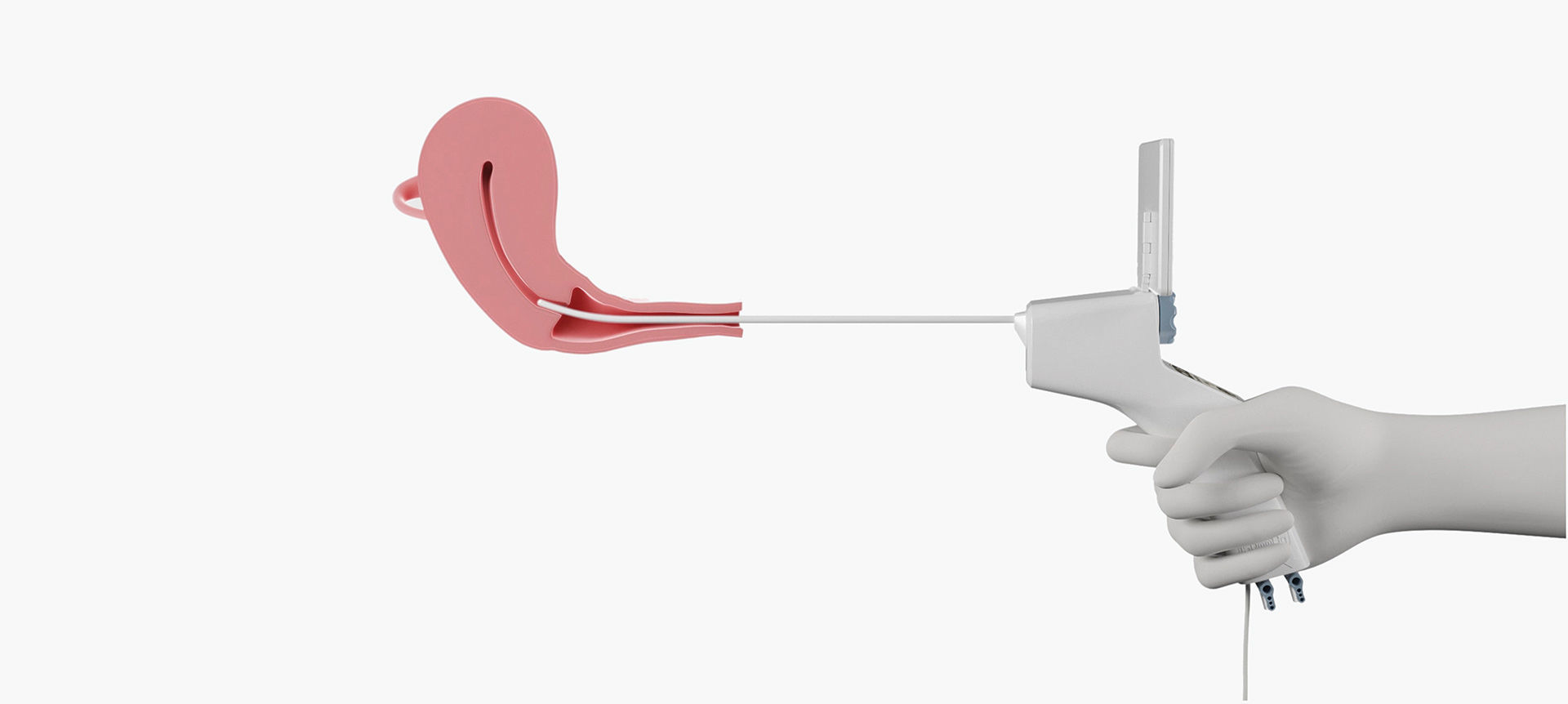 Video hysteroscope / with integrated video monitor / single use - LiNA ...