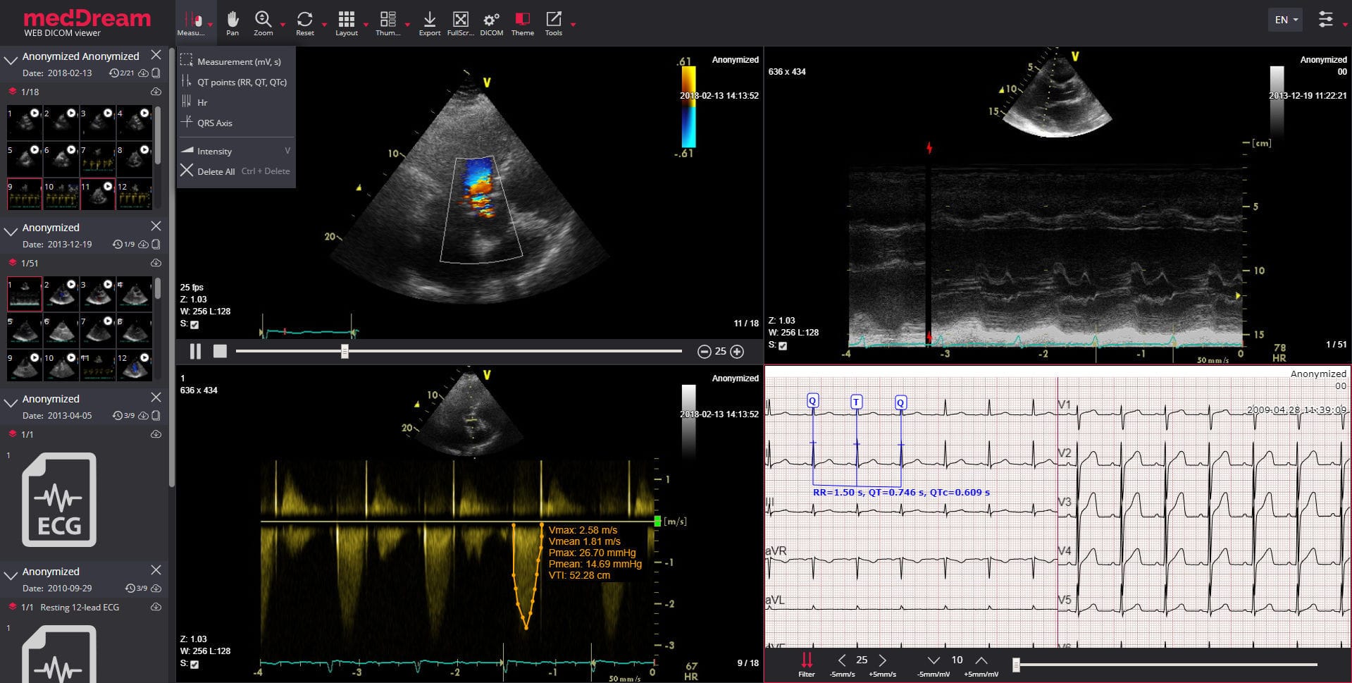 DICOM viewing software / diagnostic / for PACS / universal - MedDream ...