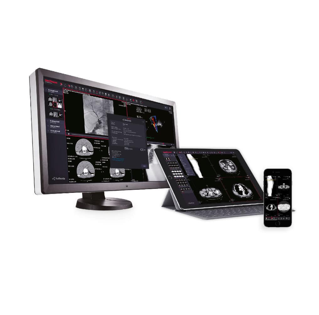 DICOM viewing software - MedDream - SOFTNETA Medical Imaging ...