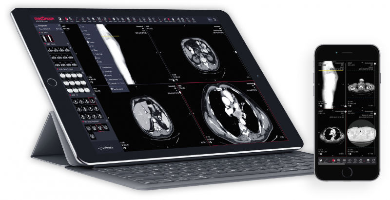 Visualization web application - MedDream - SOFTNETA Medical Imaging ...