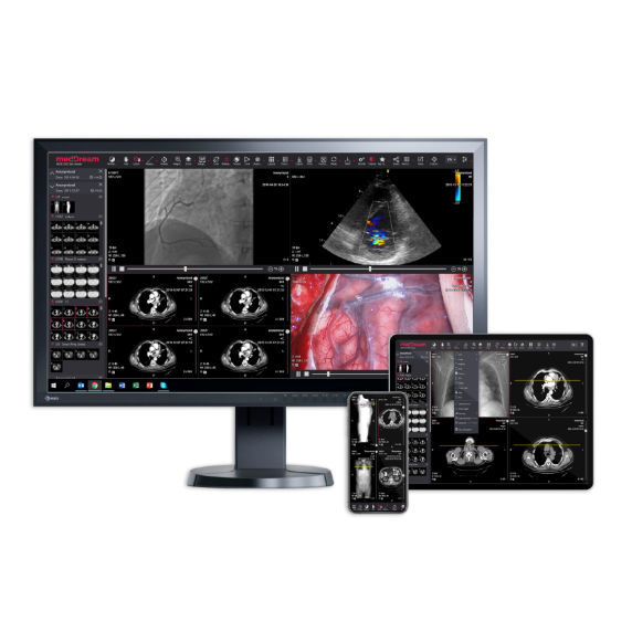 Sharing web application - MedDream - SOFTNETA Medical Imaging - visualization / education ...