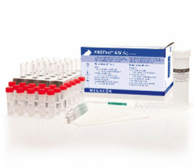 Rapid avian influenza test - FASTest® AIV Ag - MEGACOR Diagnostik - for ...