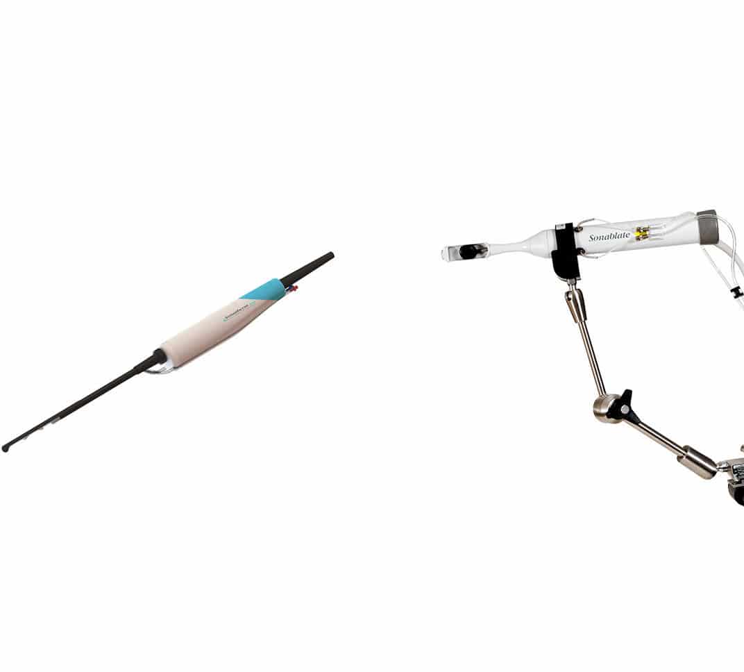Prostate tumor treatment HIFU ablation system - Sonasource® + Sonablate ...