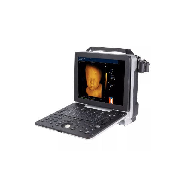 Portable ultrasound system - HF-P6 - Shanghai Huifeng Medical ...