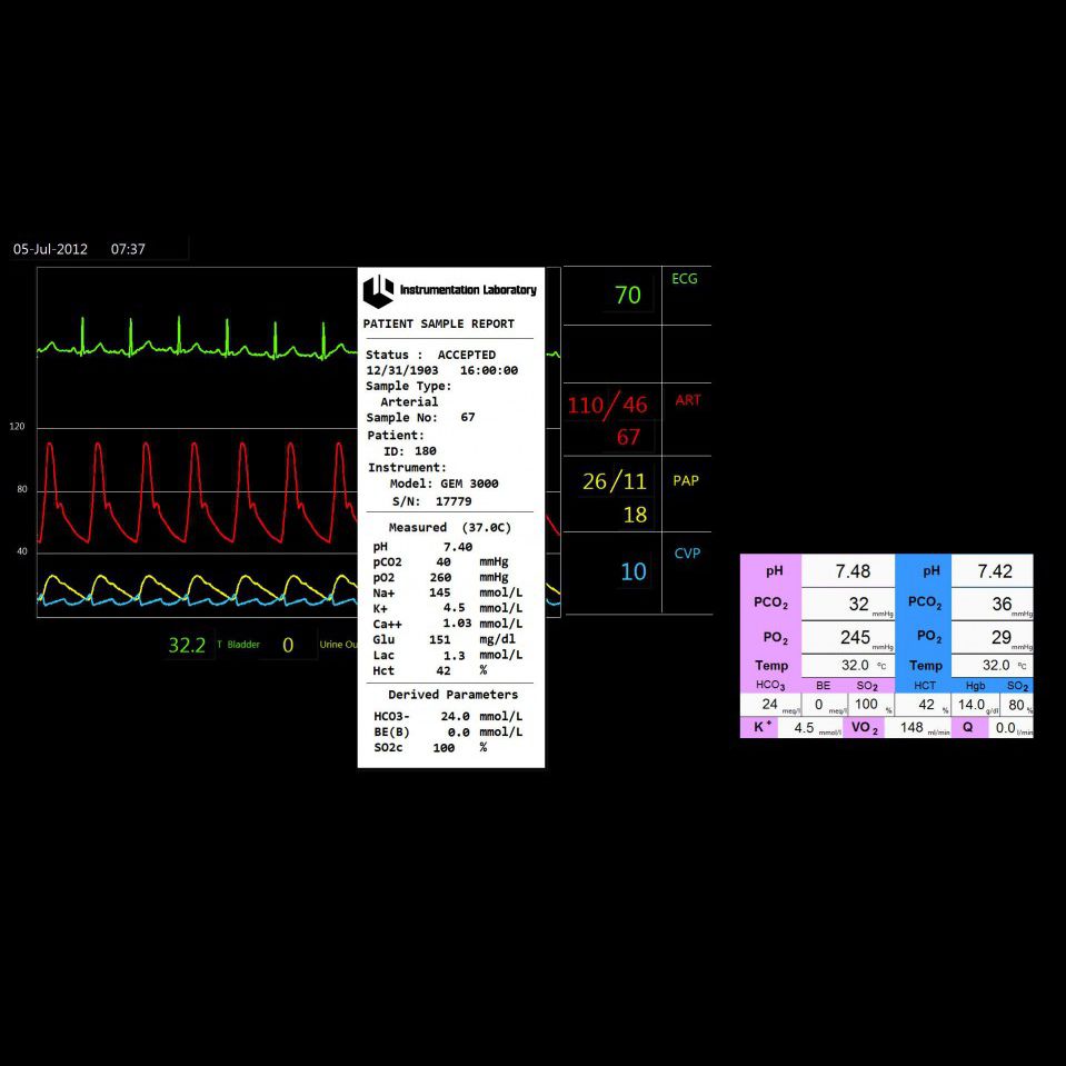 Cardiopulmonary care patient simulator / for ECMO / monitor ...