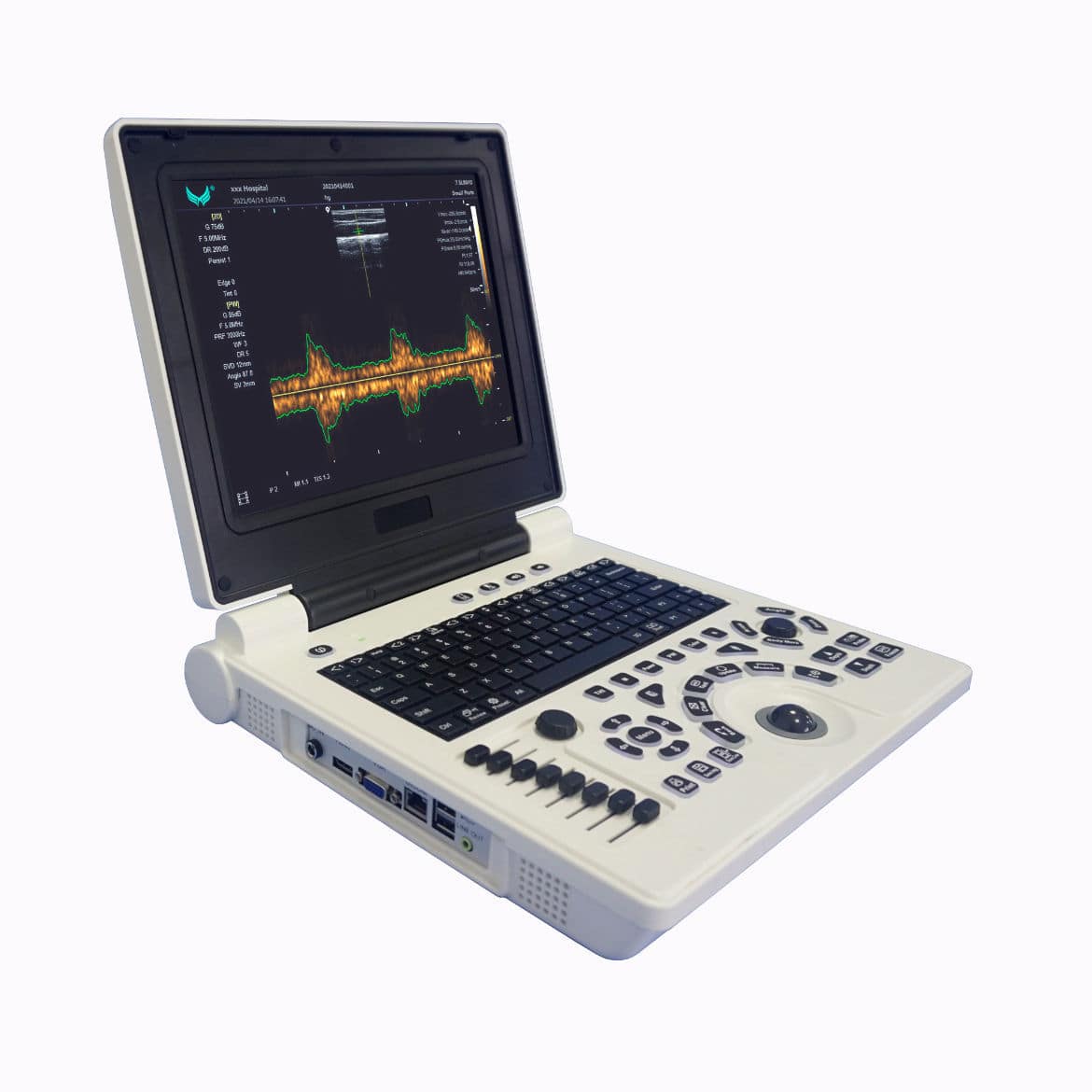 Portable ultrasound system - E20 - Xianfeng Ultrasound Medical - for multipurpose ultrasound ...