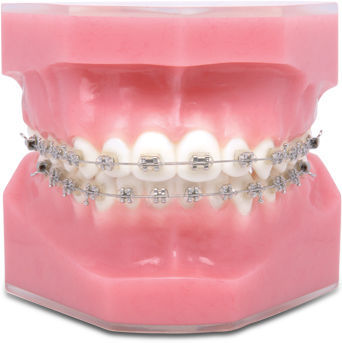 Nickel titanium orthodontic archwire - TP Orthodontics - stainless ...