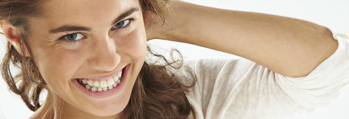 Aesthetic orthodontic bracket - Chic - GC Orthodontics - ceramic ...