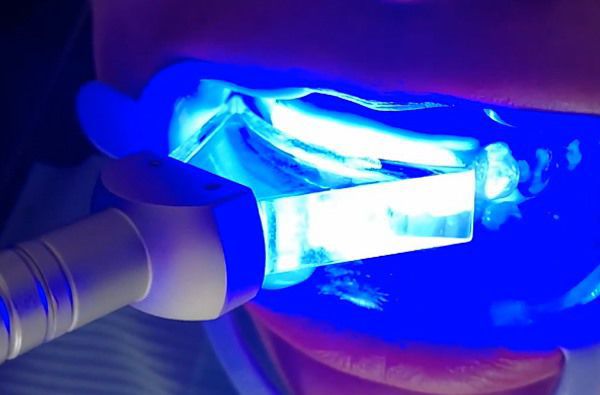 Dental handpiece - Whitening - Pioon Medical Laser - laser / direct ...