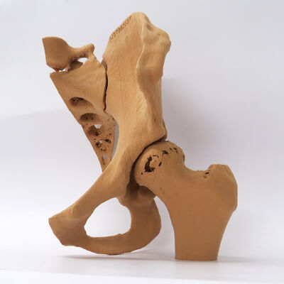 Bone model - 3D Lifeprints UK Ltd - pelvis / hip / training