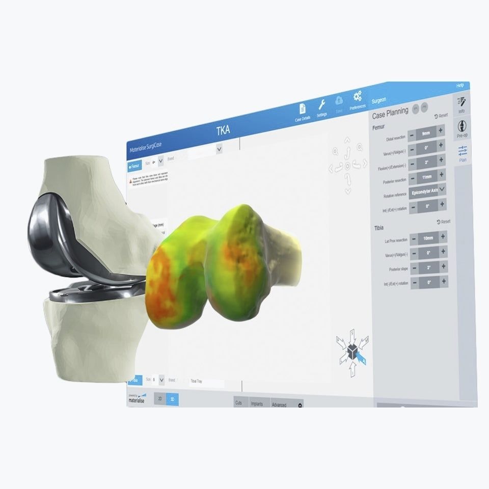 3D viewing software - Materialise UK - planning / surgical / preoperative