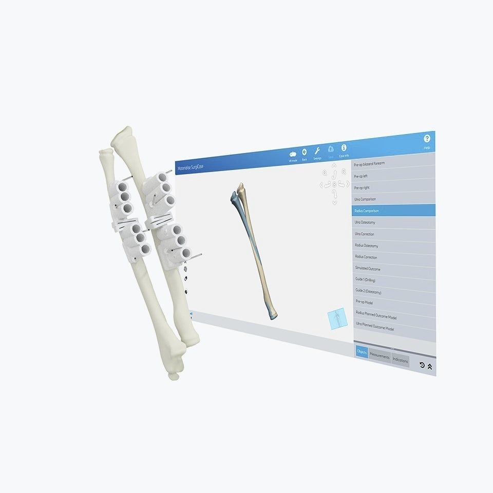 Analysis software - Materialise UK - preoperative planning / medical ...