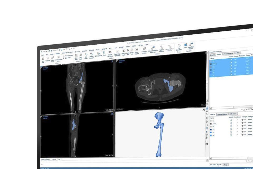 Measurement software - Mimics - Materialise UK - medical / clinical ...