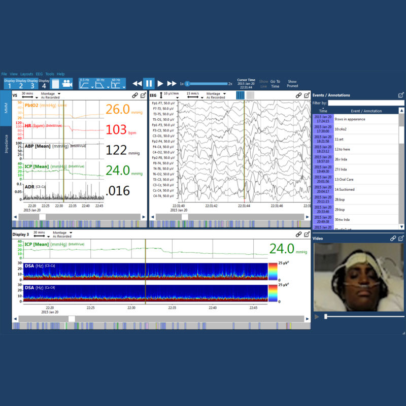 Clinical biosignal acquisition system - CNS Envision - Micromed Italy ...