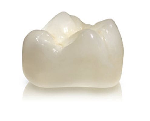 Zirconia dental crown - DIAMOND - Derby Dental - posterior teeth ...