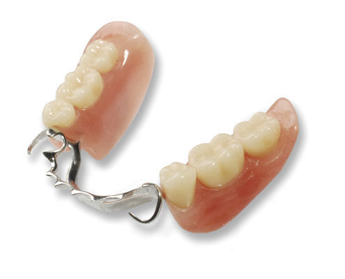 Anterior teeth dental prosthesis - Cast Partial - Derby Dental ...