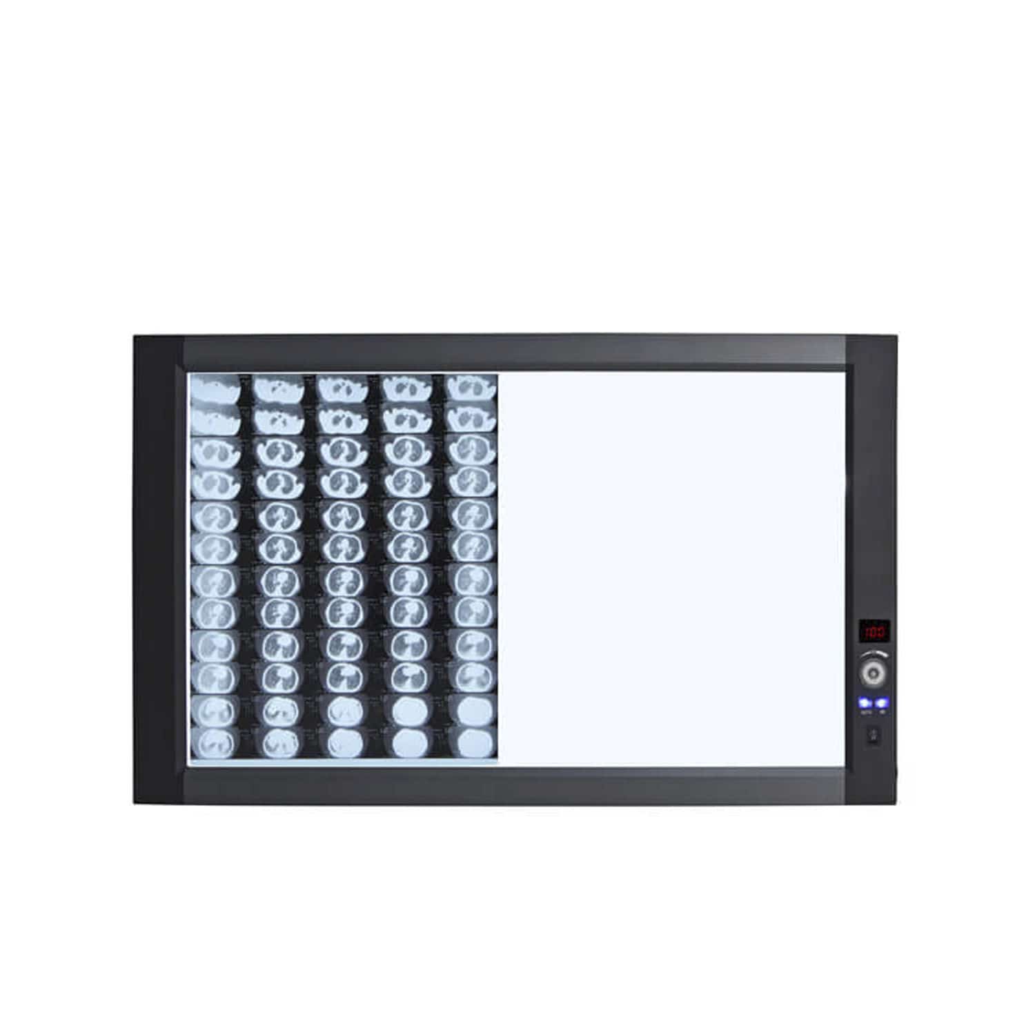 1-screen X-ray film viewer - FV-1D - AMCAREMED TECHNOLOGY - 2-screen ...