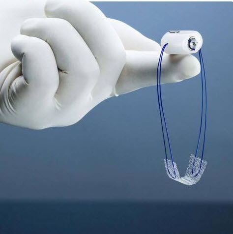 Urinary incontinence reconstruction mesh - Remeex - Neomedic ...